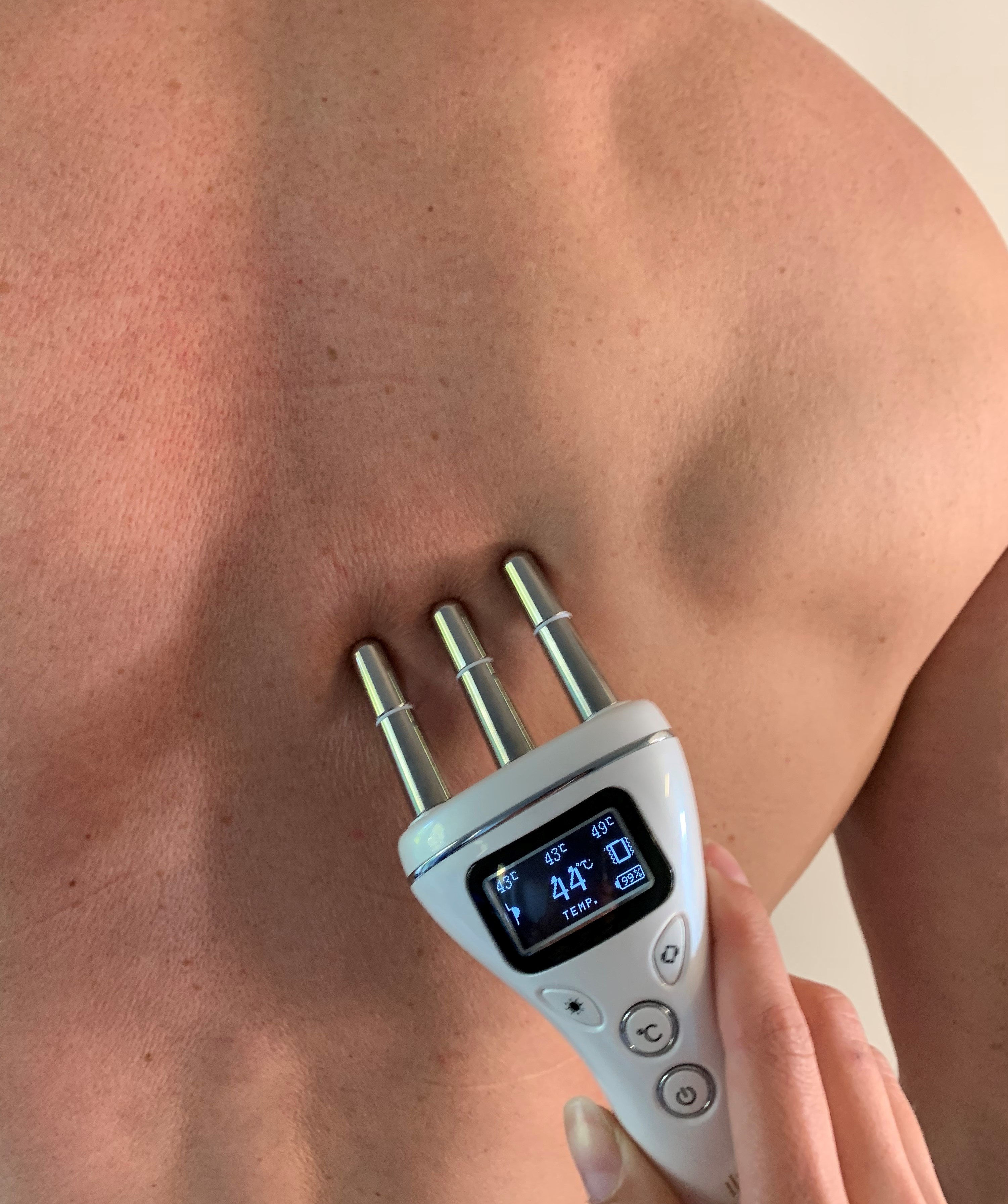 The Thermal Wand | Animal Axis